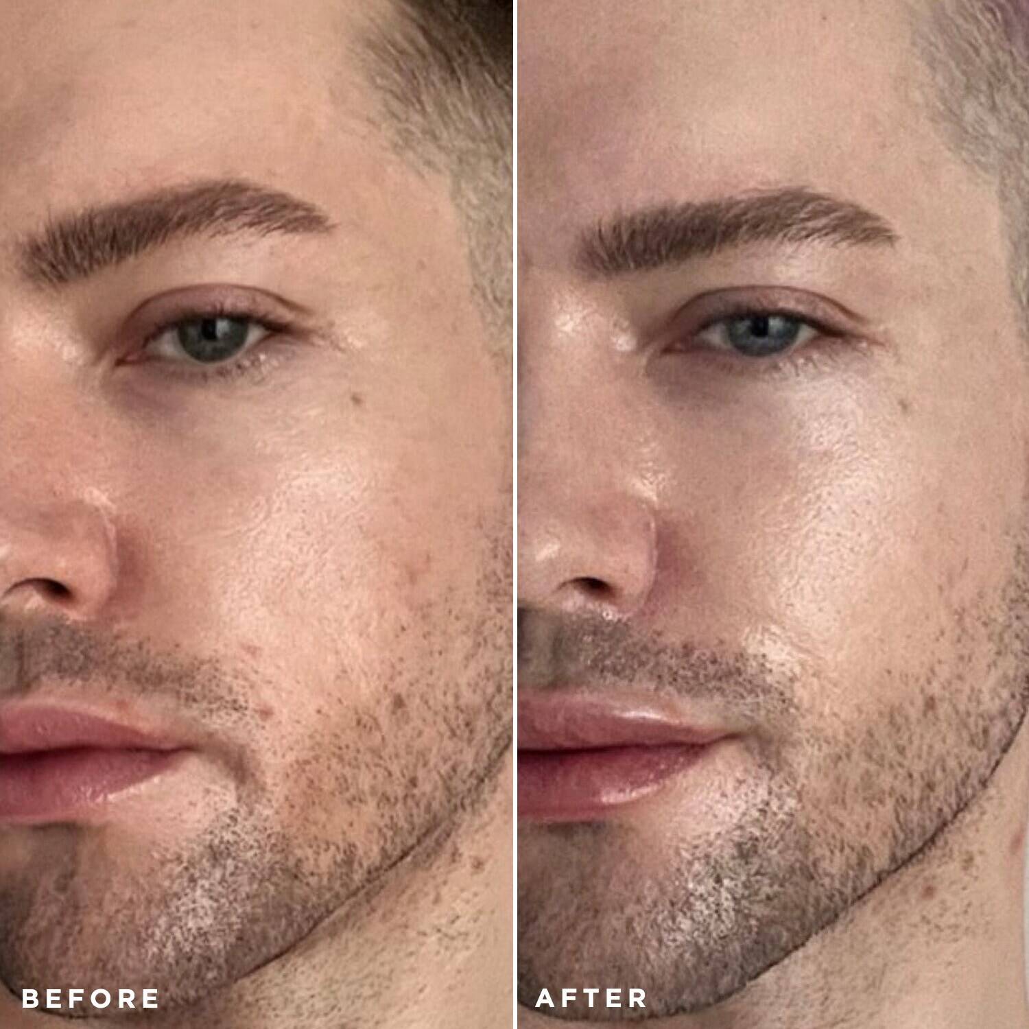 Dr Sam's Flawless Moisturiser Intense 50ml | SEPHORA UK