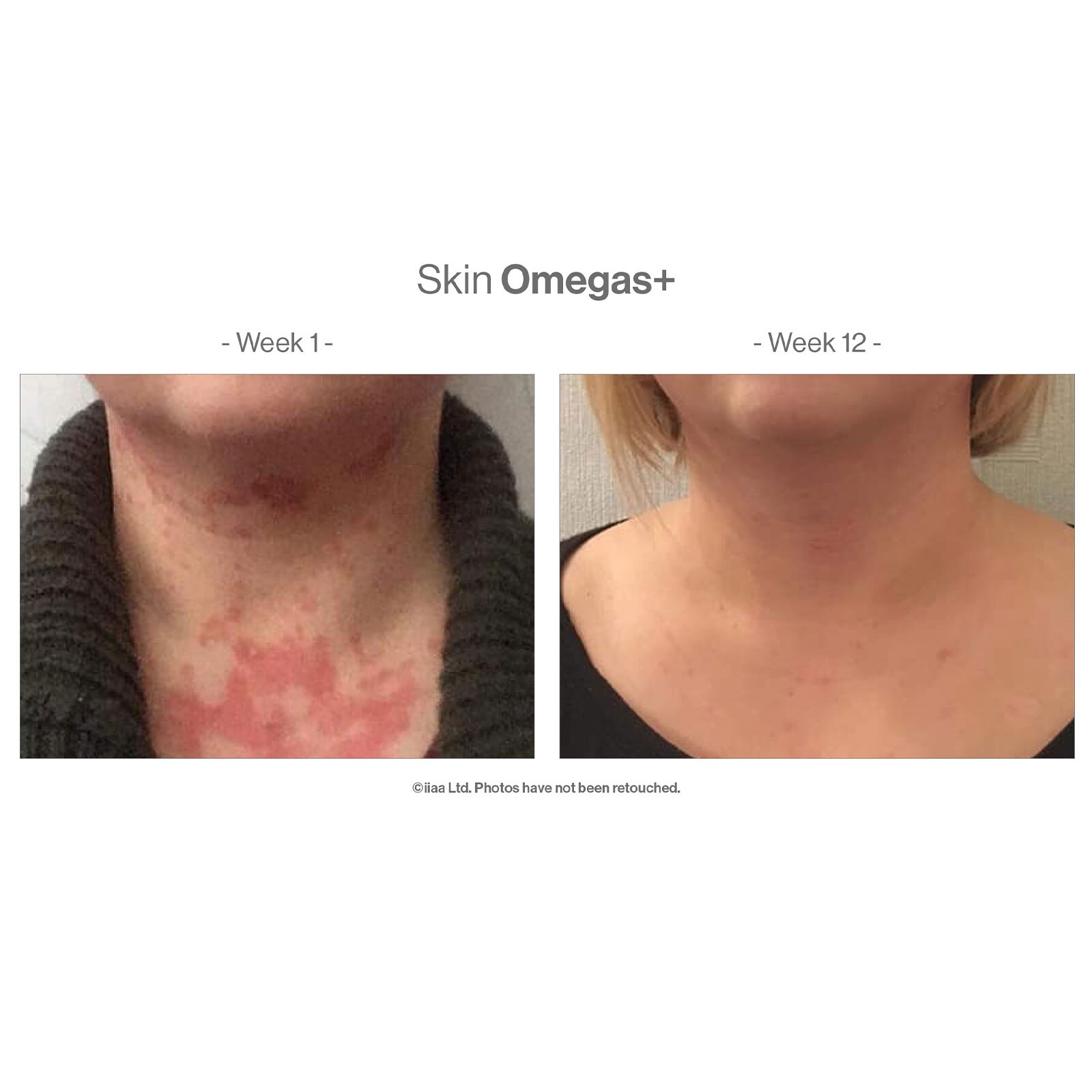 Advanced Nutrition Programme™ Skin Omegas+ Food Supplement x 180 ...